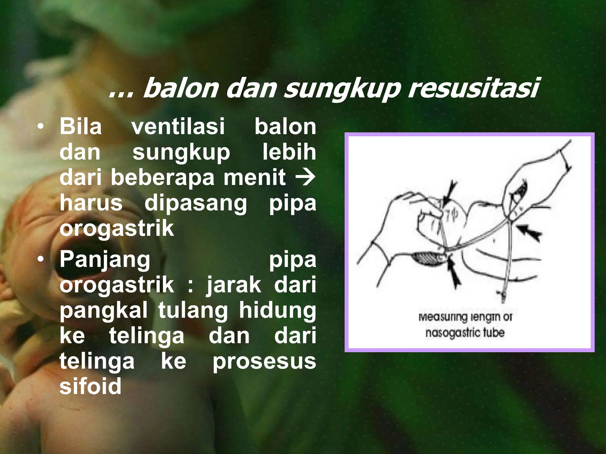 power point RESUSITASI NEONATUS / bayi baru lahir | PPTX