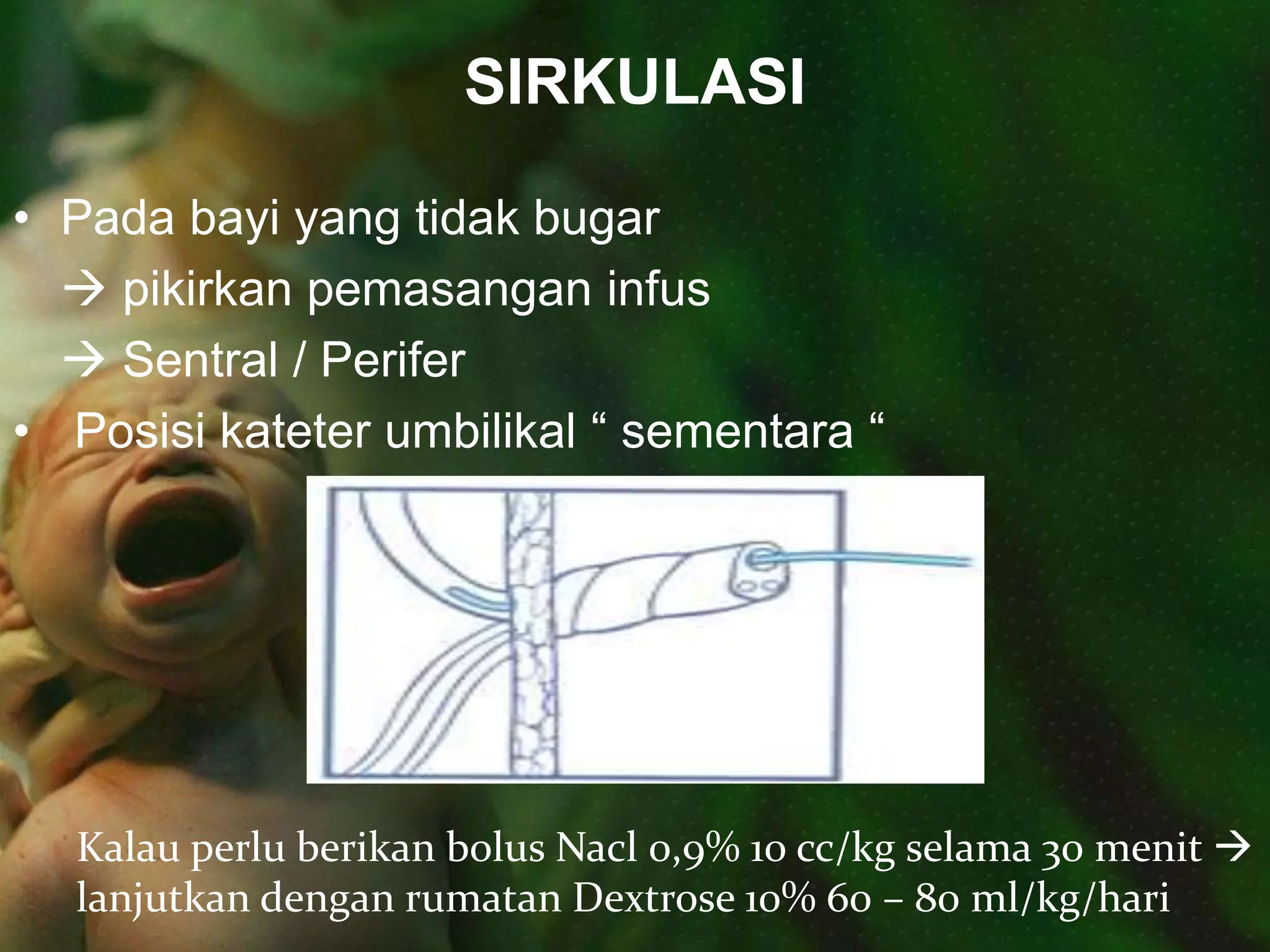 power point RESUSITASI NEONATUS / bayi baru lahir | PPTX