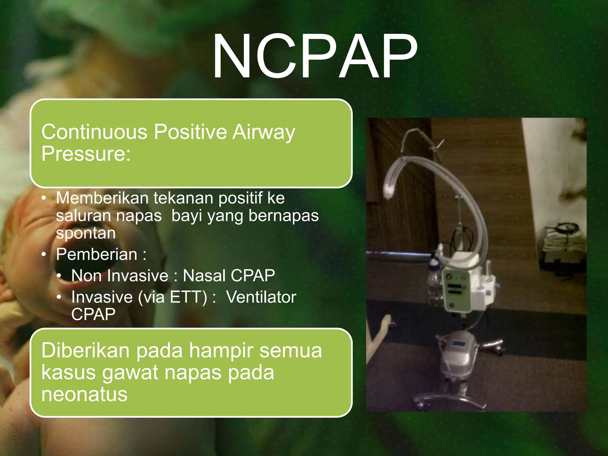 power point RESUSITASI NEONATUS / bayi baru lahir | PPTX