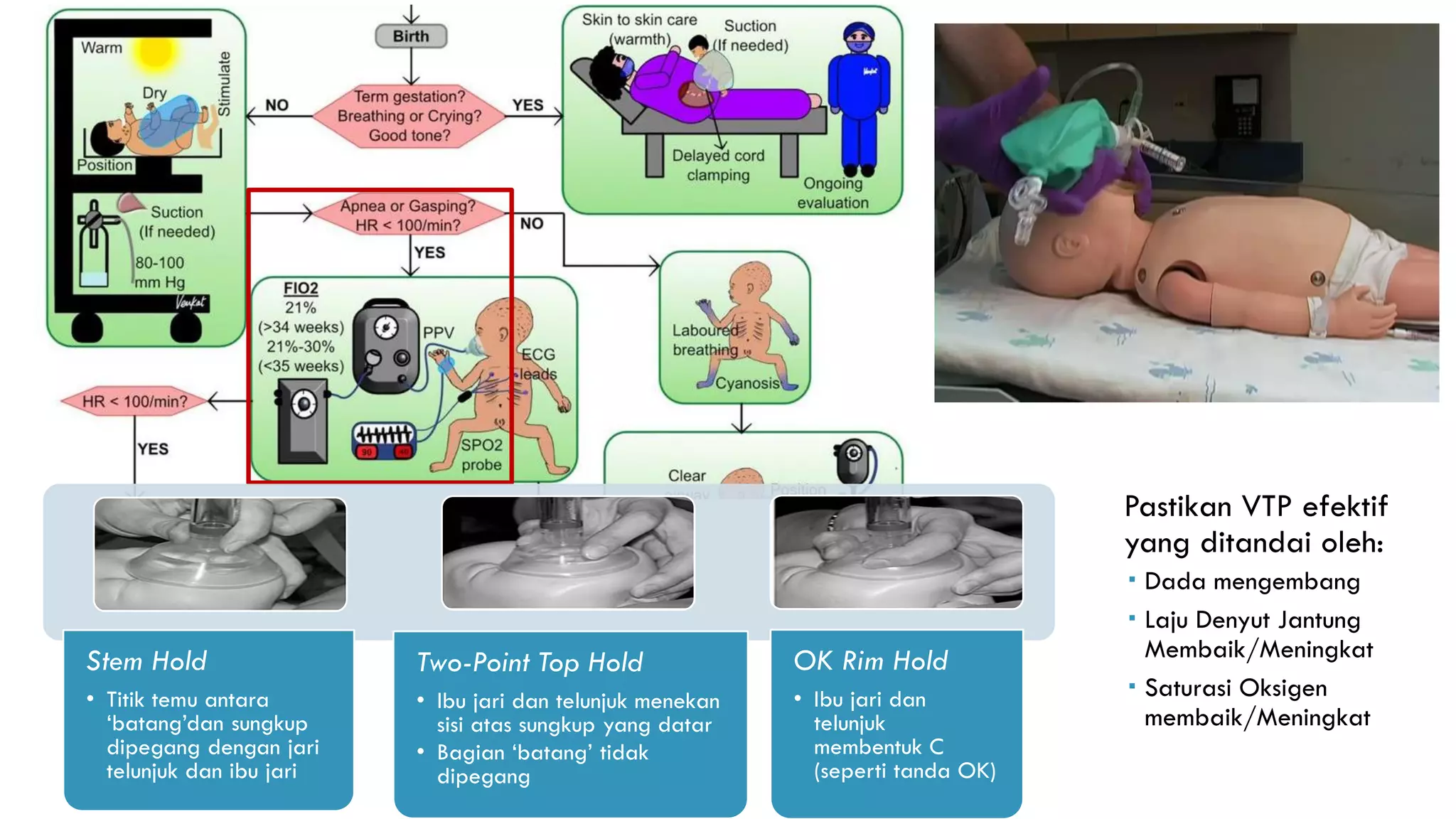Resusitasi, Stabilisasi, dan Transportasi Neonatus.pdf