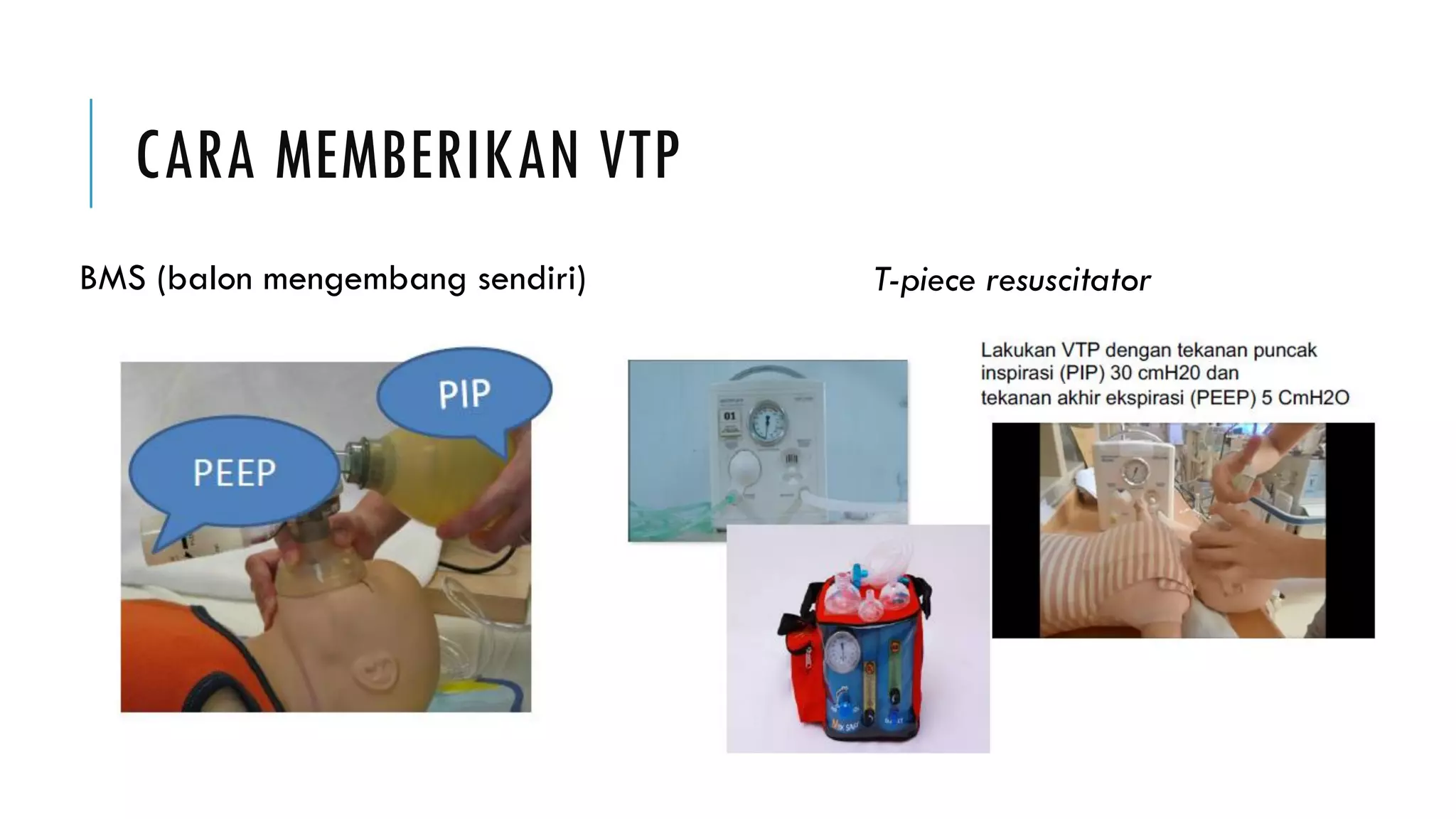 Resusitasi, Stabilisasi, dan Transportasi Neonatus.pdf