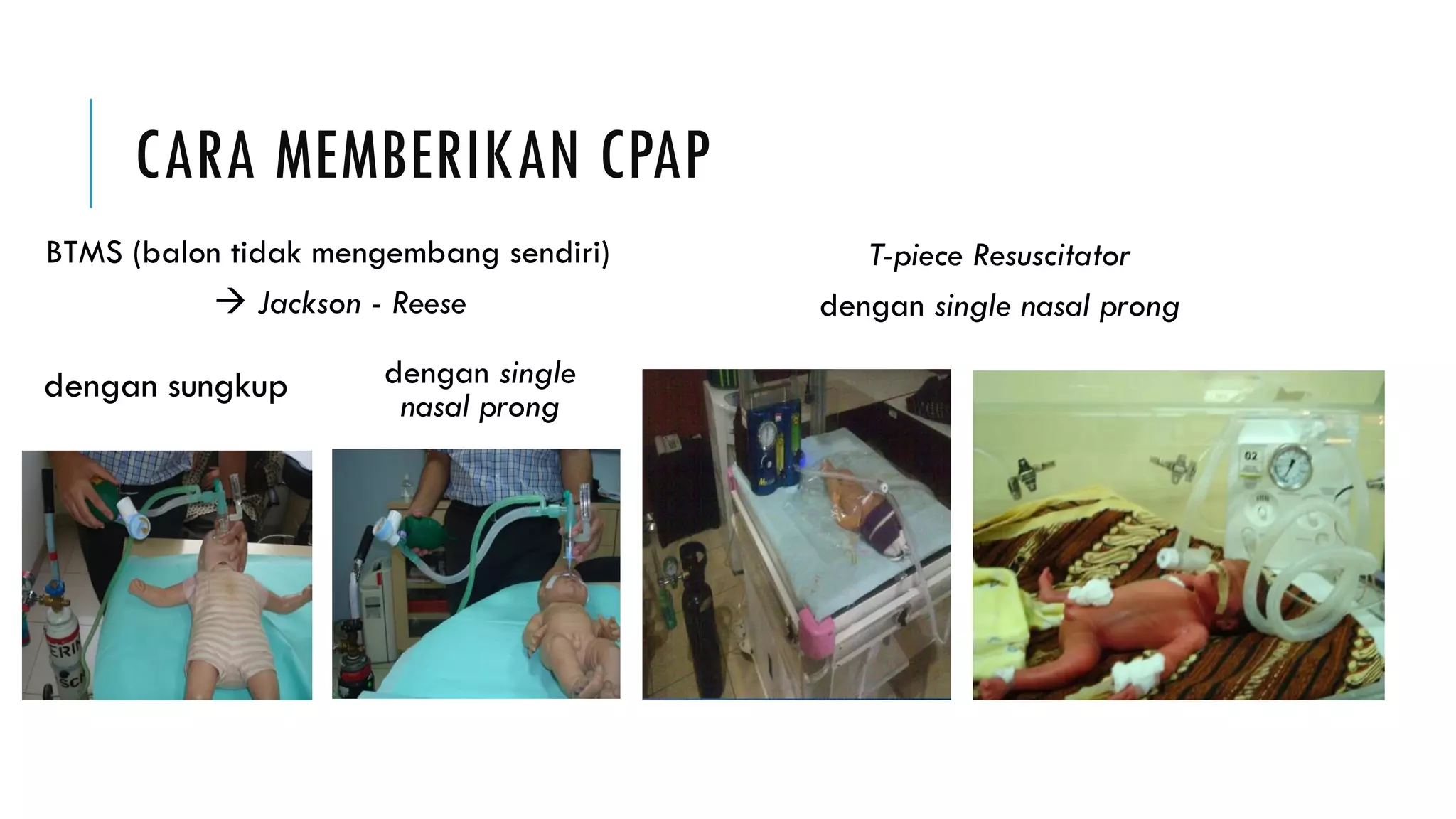 Resusitasi, Stabilisasi, dan Transportasi Neonatus.pdf