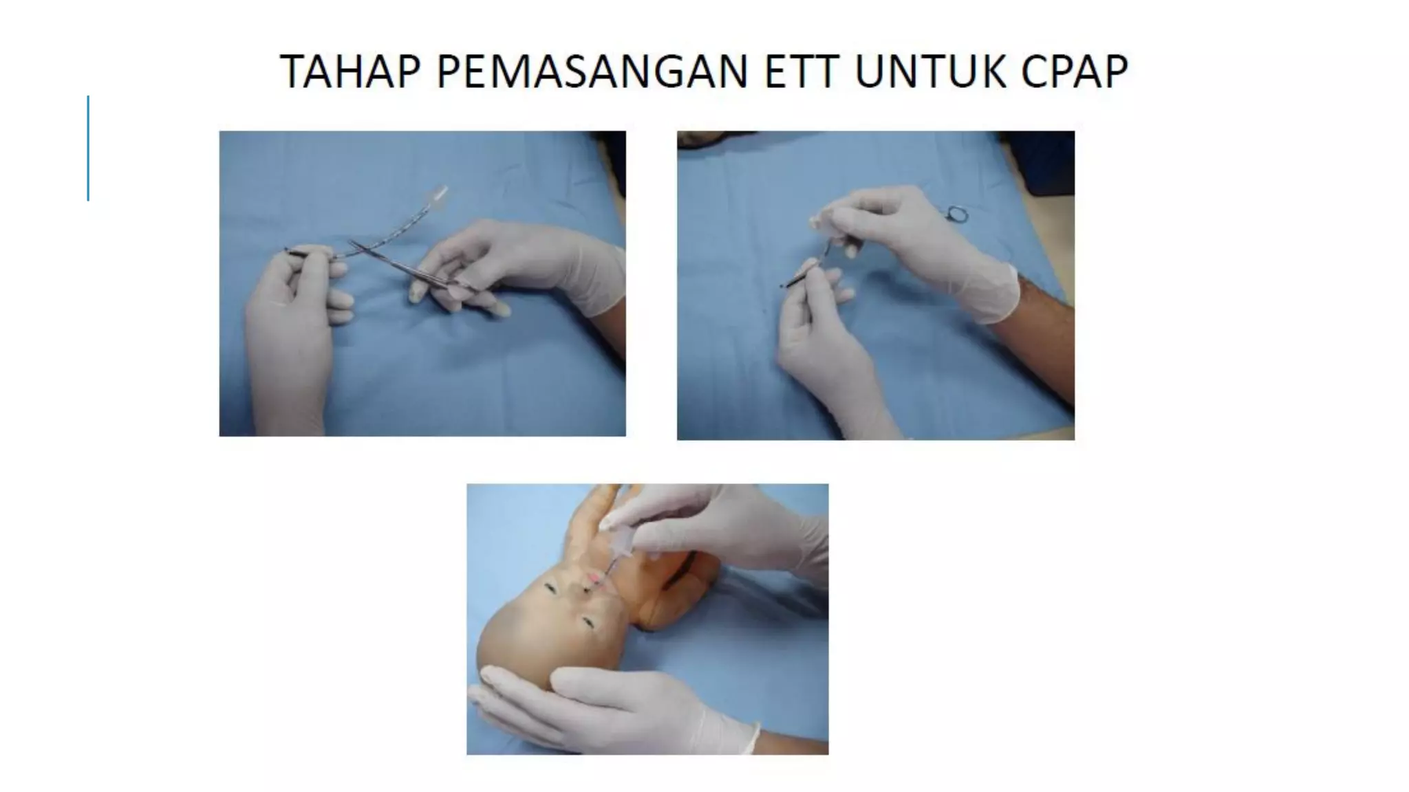 Resusitasi, Stabilisasi, dan Transportasi Neonatus.pdf