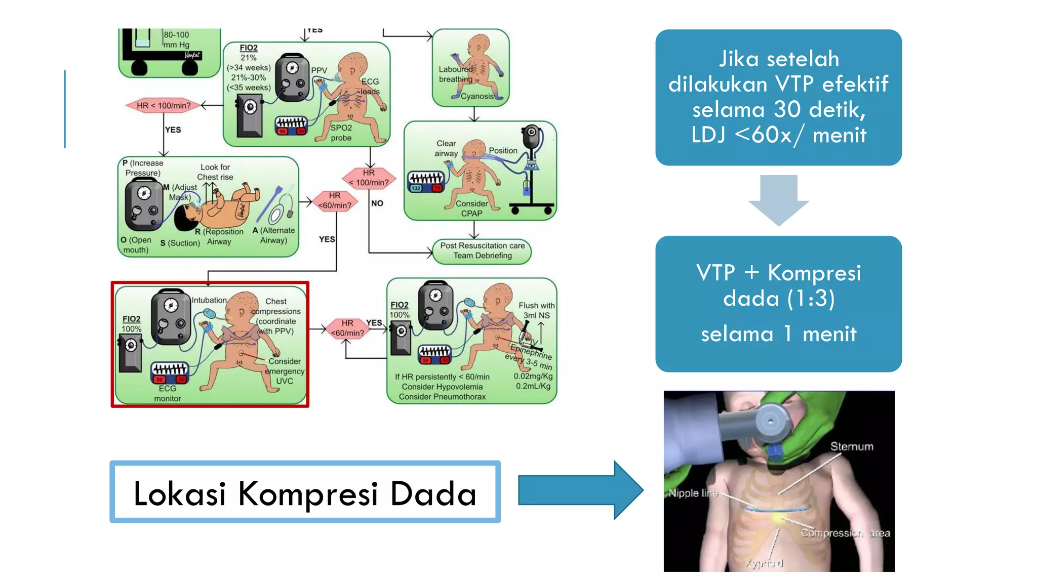 Resusitasi, Stabilisasi, dan Transportasi Neonatus.pdf