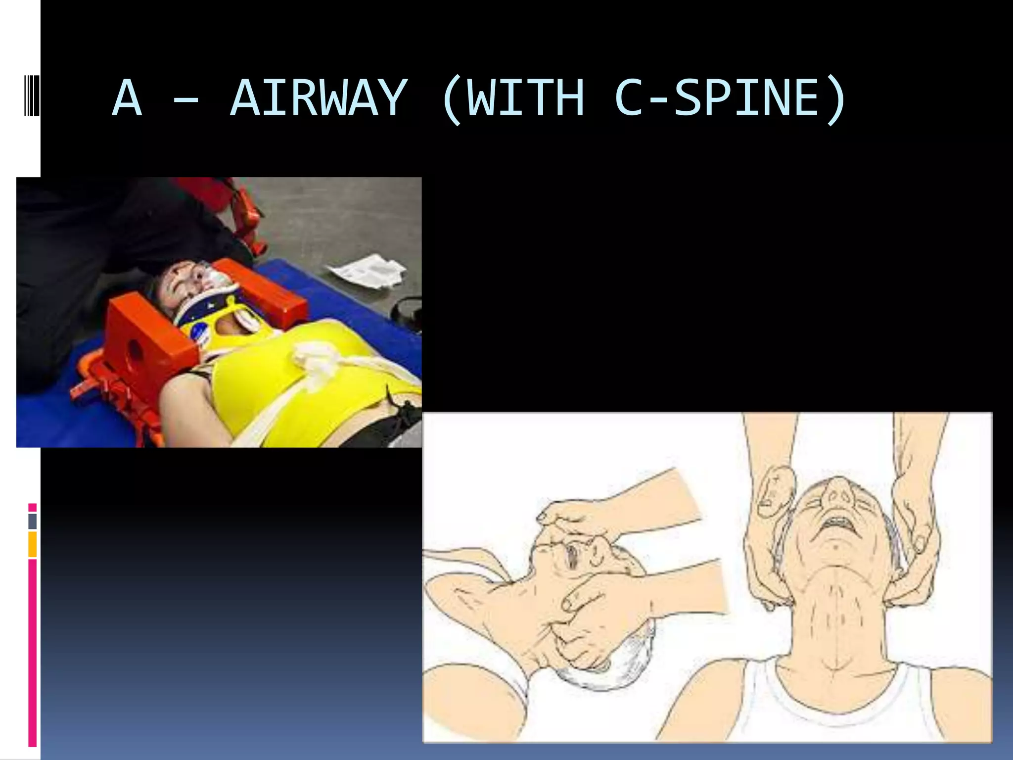 Resus & primary mx of trauma | PPT