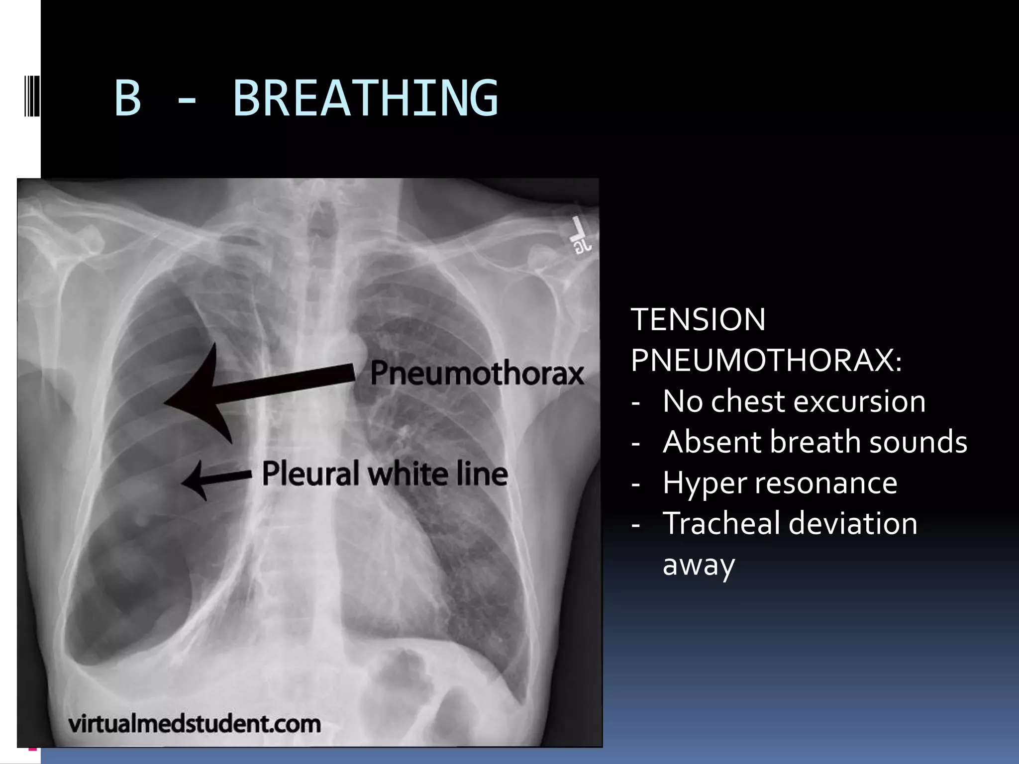 Resus & primary mx of trauma | PPT