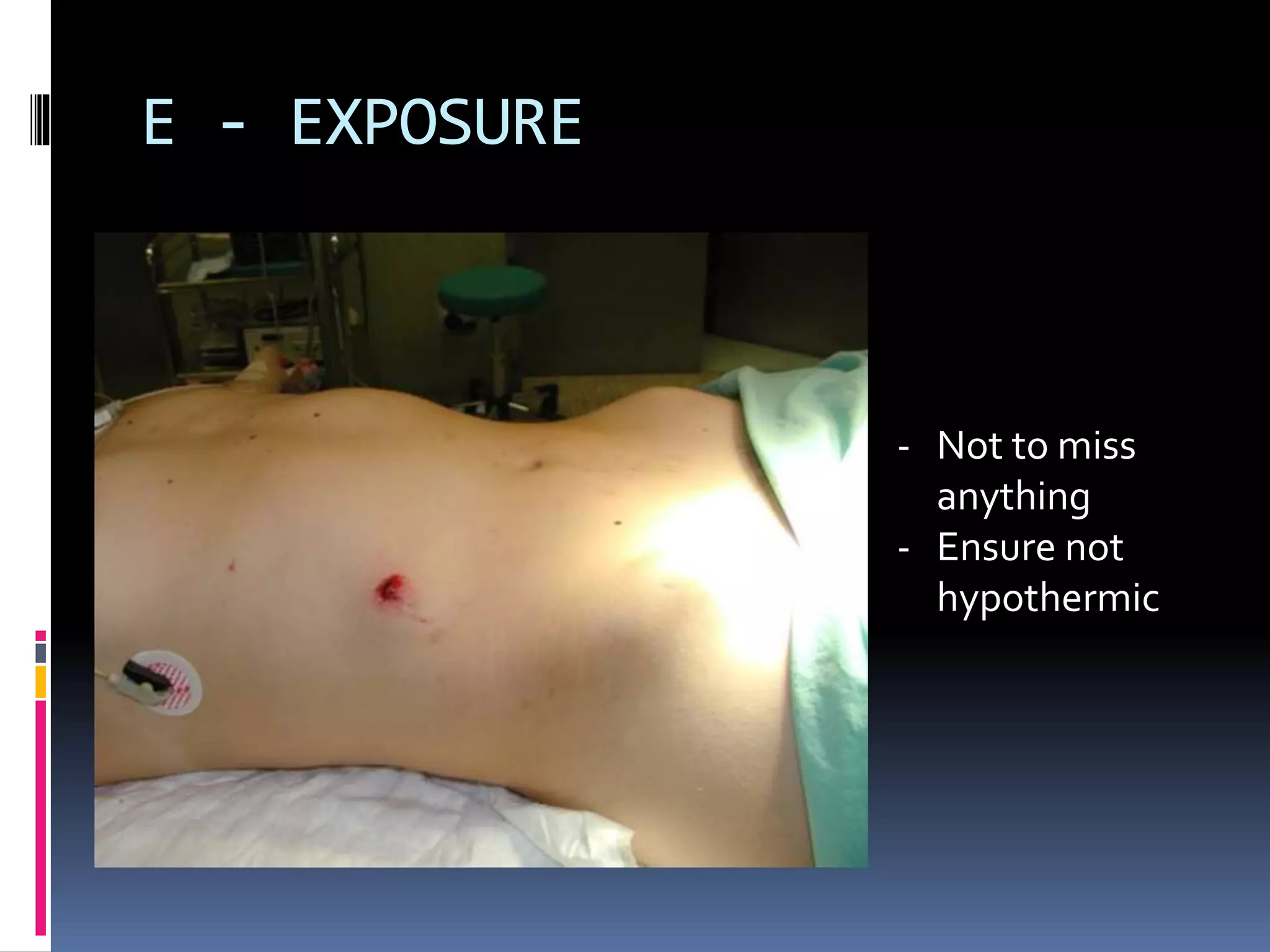 Resus & primary mx of trauma | PPT