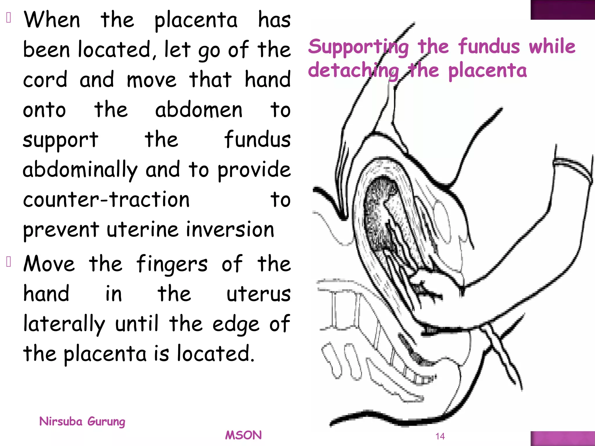 Retained placenta | PPT | Pregnancy | Reproductive Health