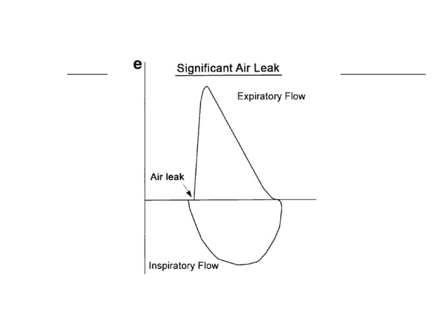Spirometry Interpretation | PPT