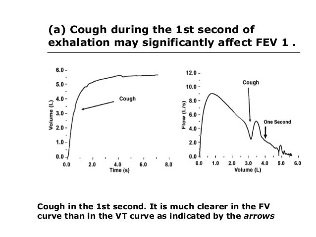 Spirometry Interpretation
