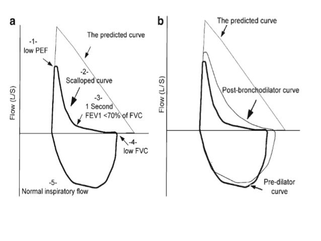 Spirometry Interpretation