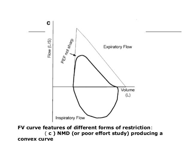 Spirometry Interpretation