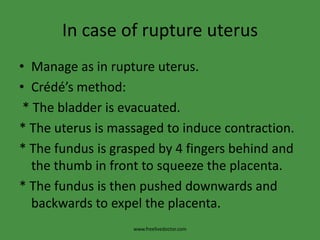 Retained placenta | PPTX