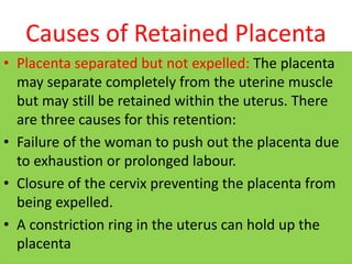 Retained placenta | PPTX
