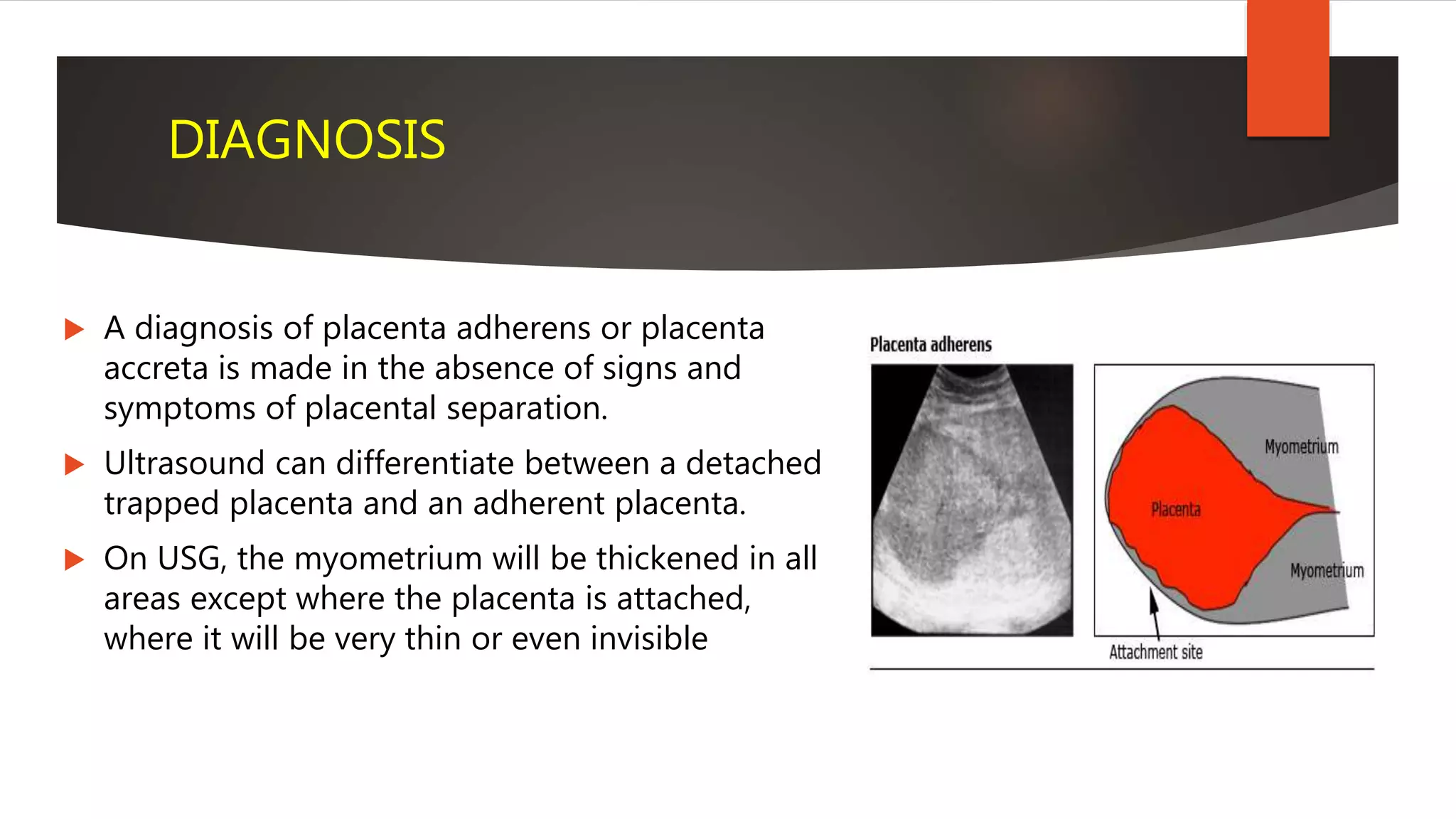 Retained placenta | PPTX