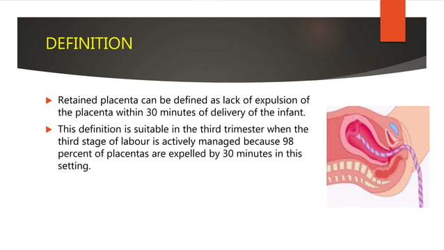 Retained placenta | PPTX | Pregnancy | Reproductive Health