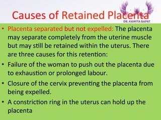 Retained placenta | PDF