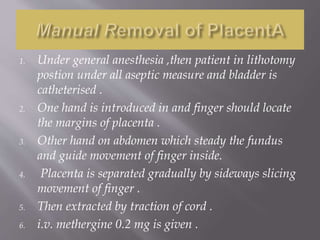 Retained placenta | PPTX