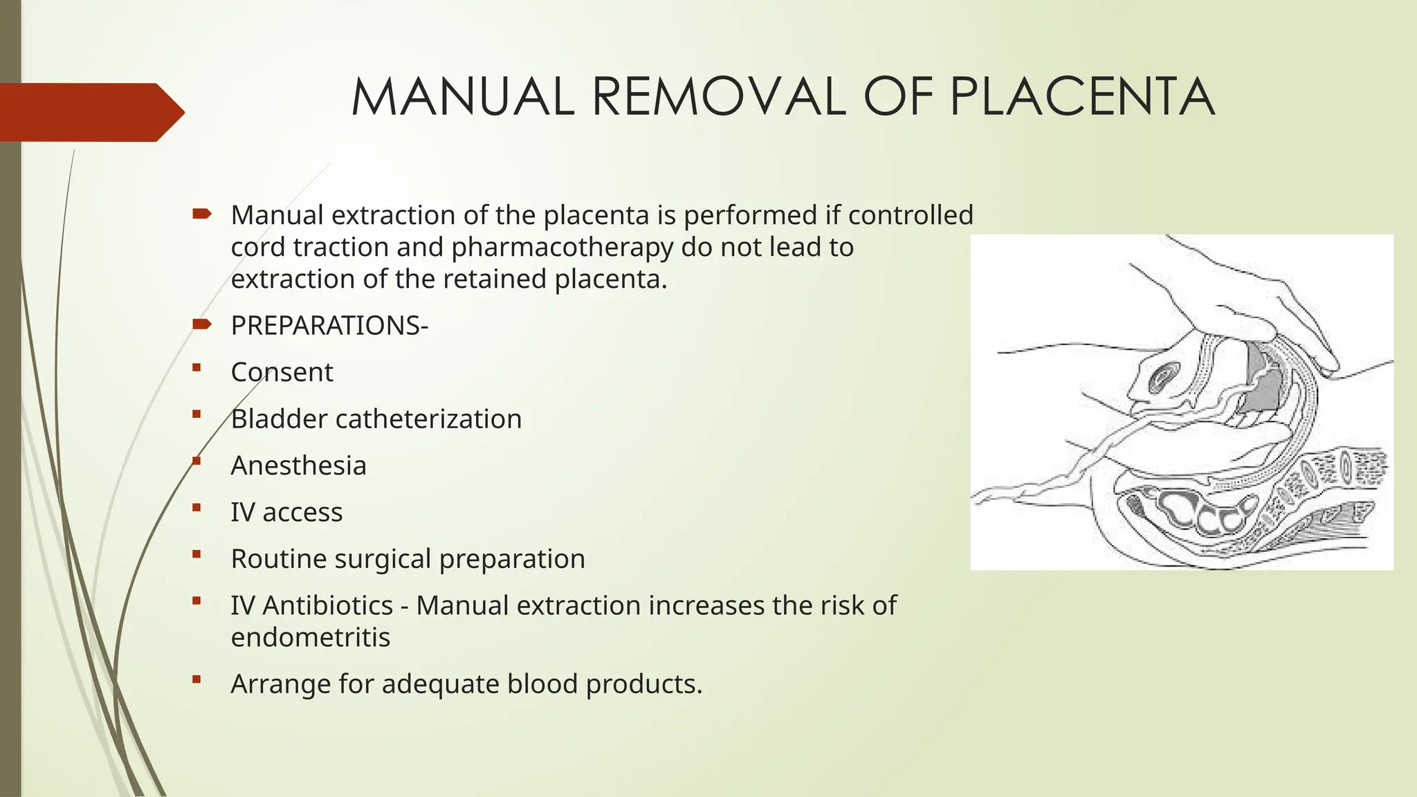 RETAINED PLACENTA - management and pptx | PPTX