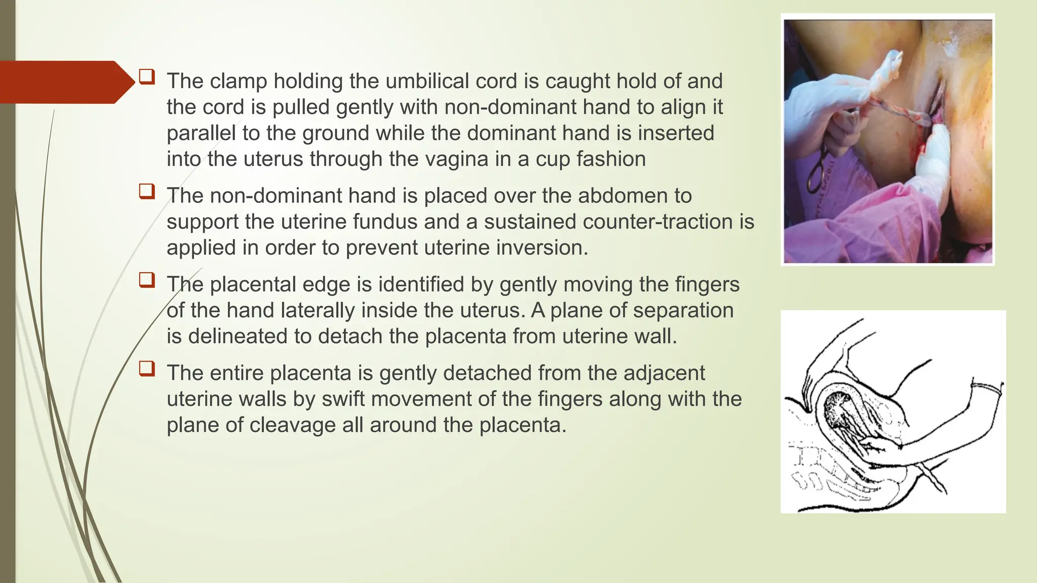 RETAINED PLACENTA - management and pptx | PPTX