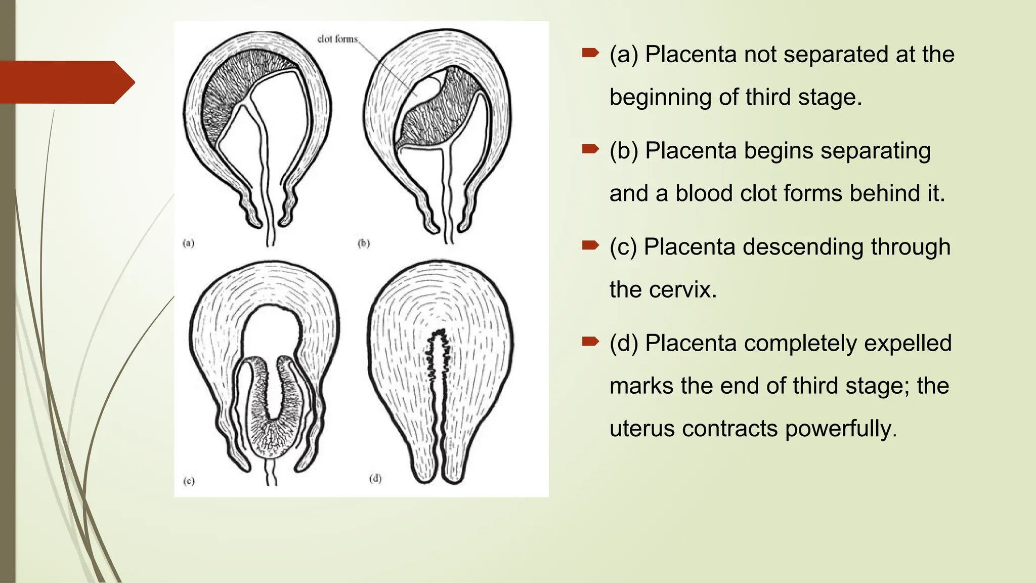 RETAINED PLACENTA - management and pptx | PPTX