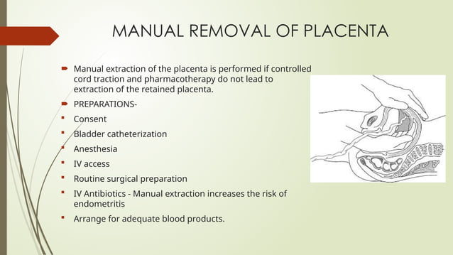 RETAINED PLACENTA - management and pptx | PPTX | Pregnancy ...