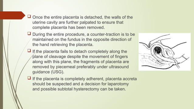 RETAINED PLACENTA - management and pptx | PPTX | Pregnancy ...