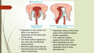 RETAINED PLACENTA - management and pptx | PPTX