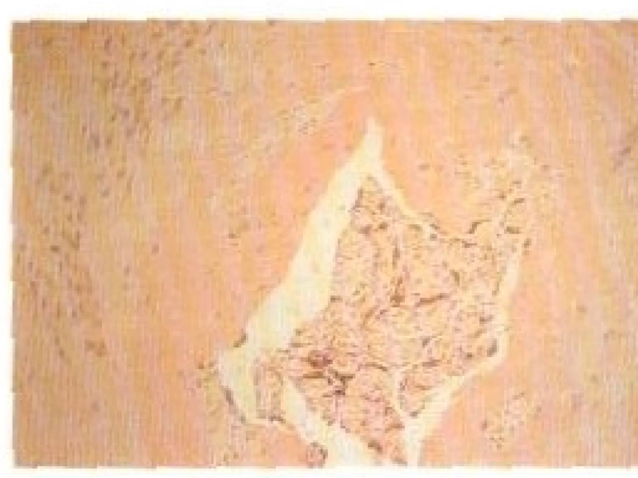 Retained Placenta - PLASENTA TERSEKAT | PPT