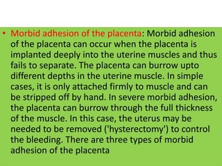 Retained Placenta 1.pdf