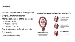 Retained placenta | PPTX