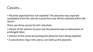Retained placenta | PPTX