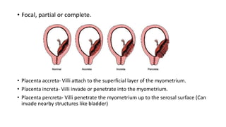 RETAINED PLACENTA AND HOW TO MANAGE IT.pptx