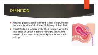 retained placenta complications and implications | PPT