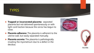 retained placenta complications and implications | PPTX