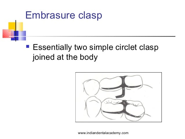 Retainers in RPD/ Labial orthodontics