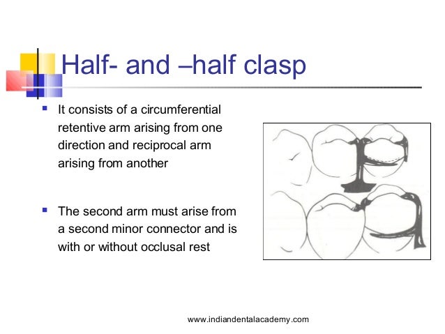 Retainers in RPD/ Labial orthodontics