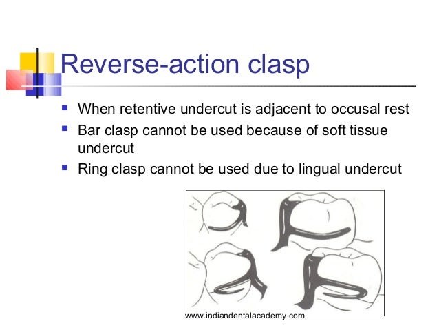 Retainers in RPD/ Labial orthodontics