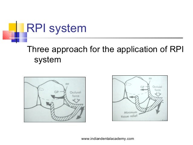 Retainers in RPD/ Labial orthodontics