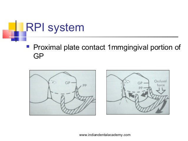 Retainers in RPD/ Labial orthodontics