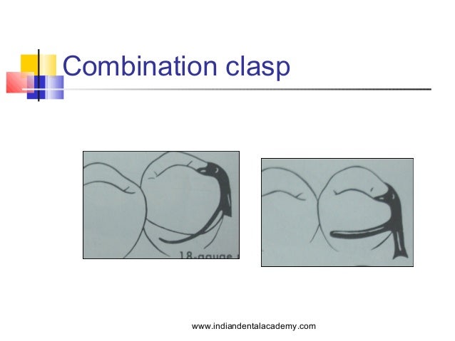 Retainers in RPD/ Labial orthodontics