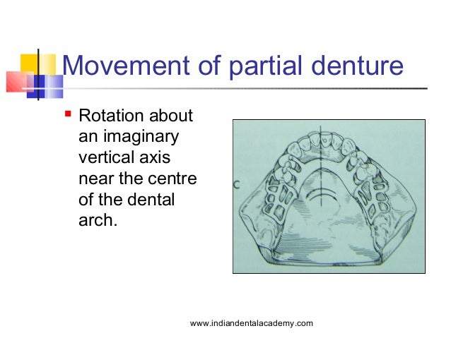 Retainers in RPD/ Labial orthodontics