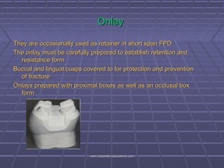 Retainers in fpd/dental courses | PPT