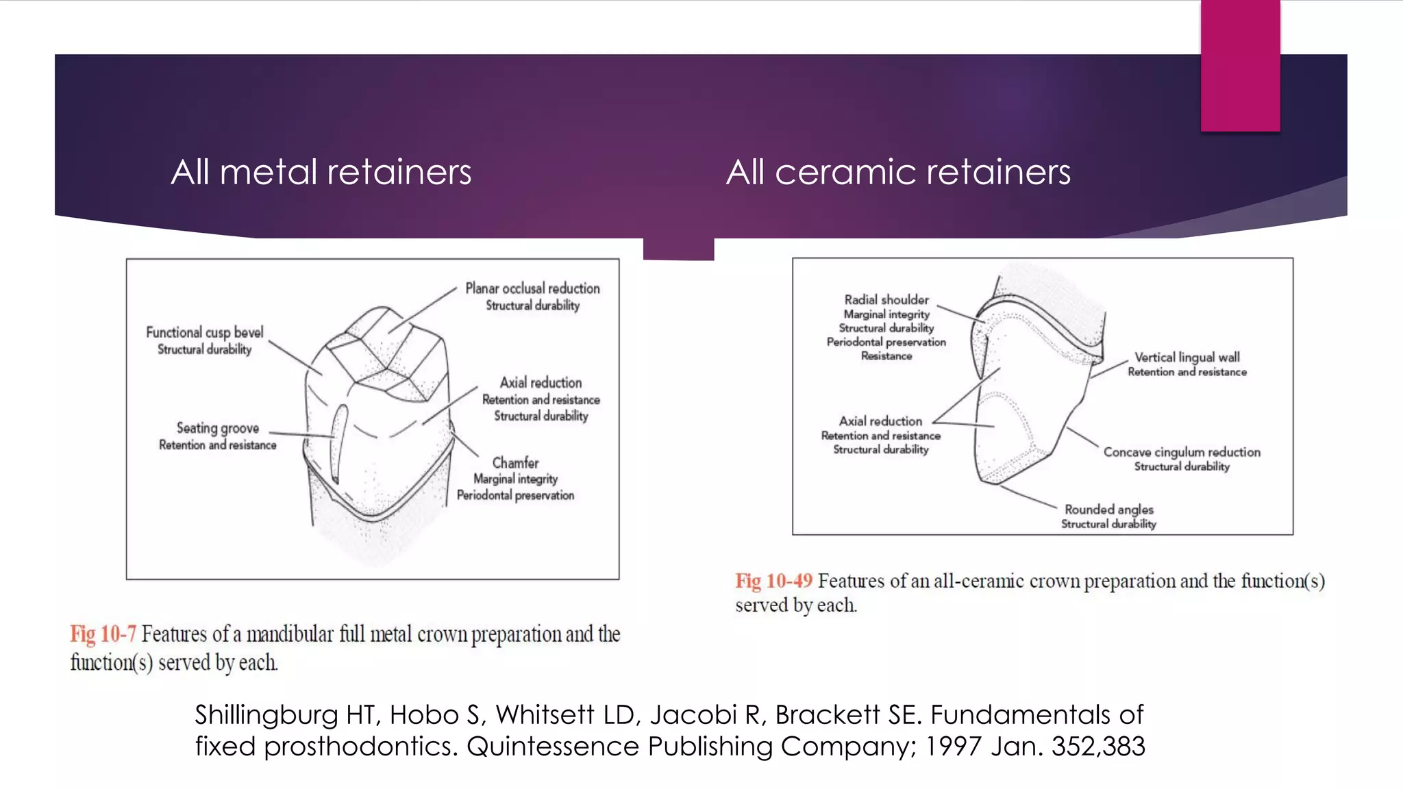 Retainers in FPD (FIXED PARTIAL DENTURES) PDF copy | PDF