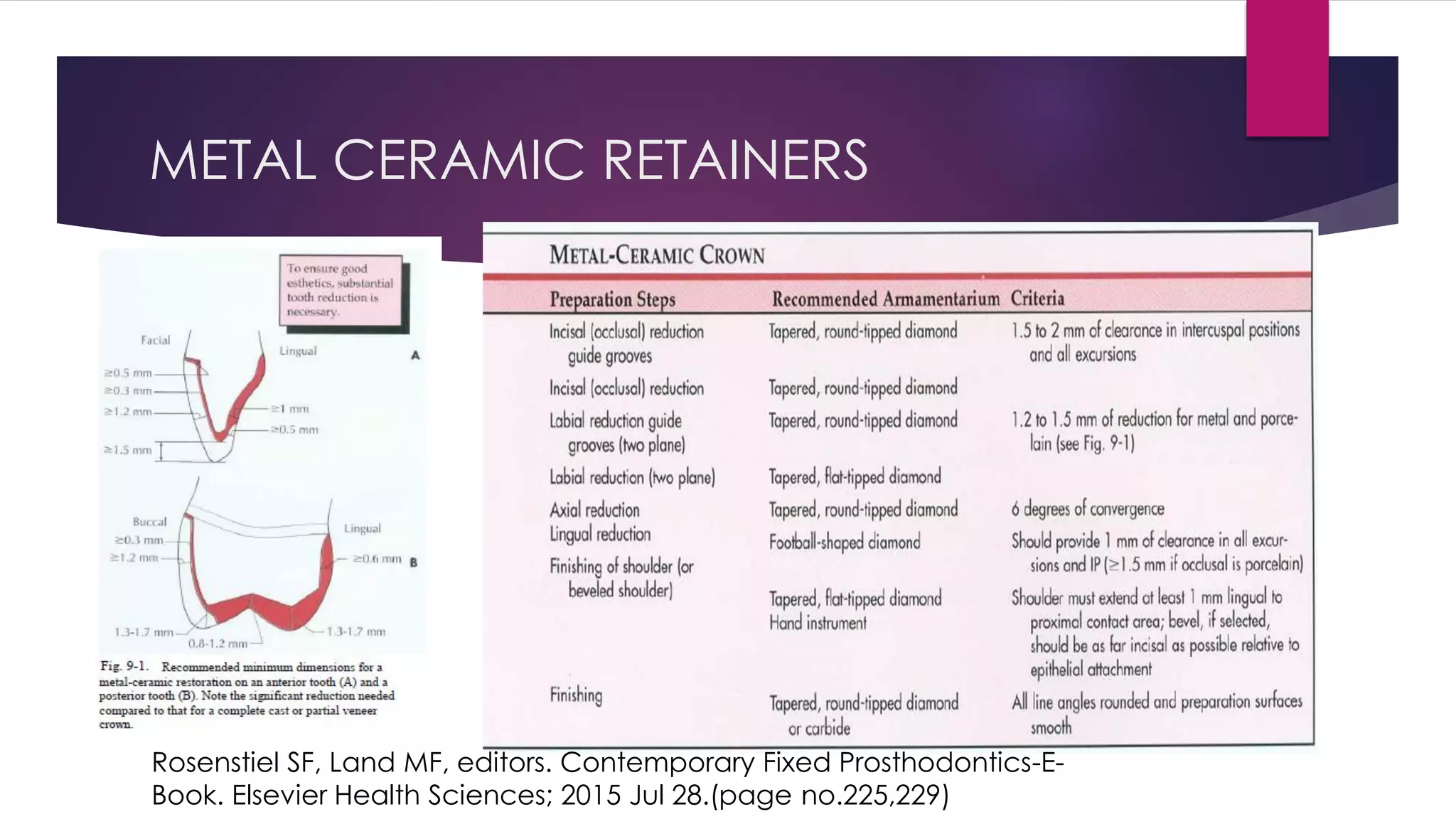 Retainers in FPD (FIXED PARTIAL DENTURES) PDF copy | PDF