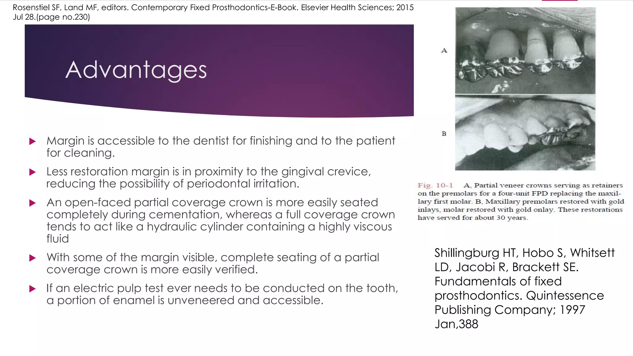 Retainers in FPD (FIXED PARTIAL DENTURES) PDF copy | PDF