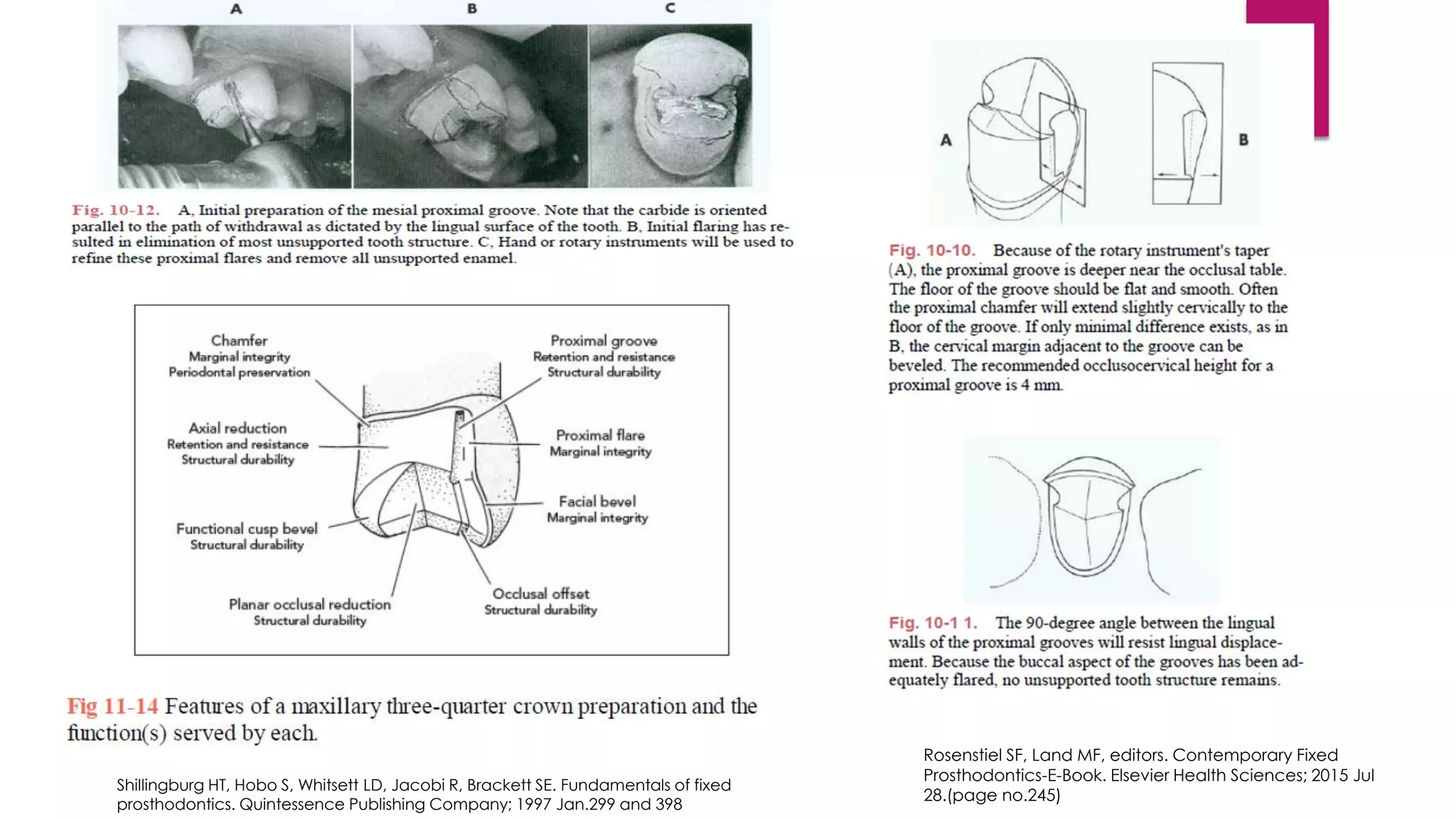 Retainers in FPD (FIXED PARTIAL DENTURES) PDF copy | PDF