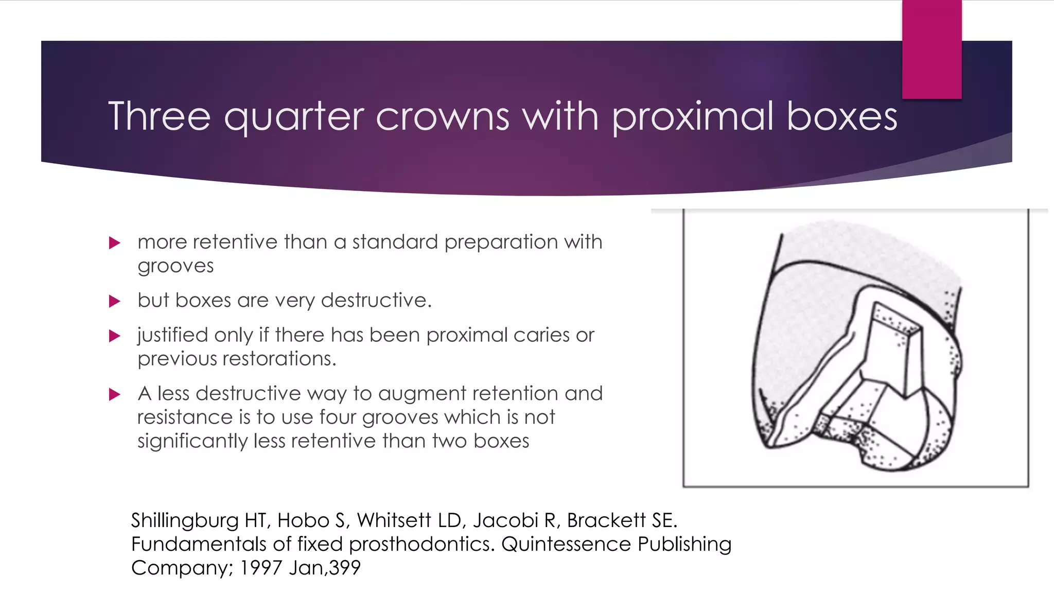 Retainers in FPD (FIXED PARTIAL DENTURES) PDF copy | PDF