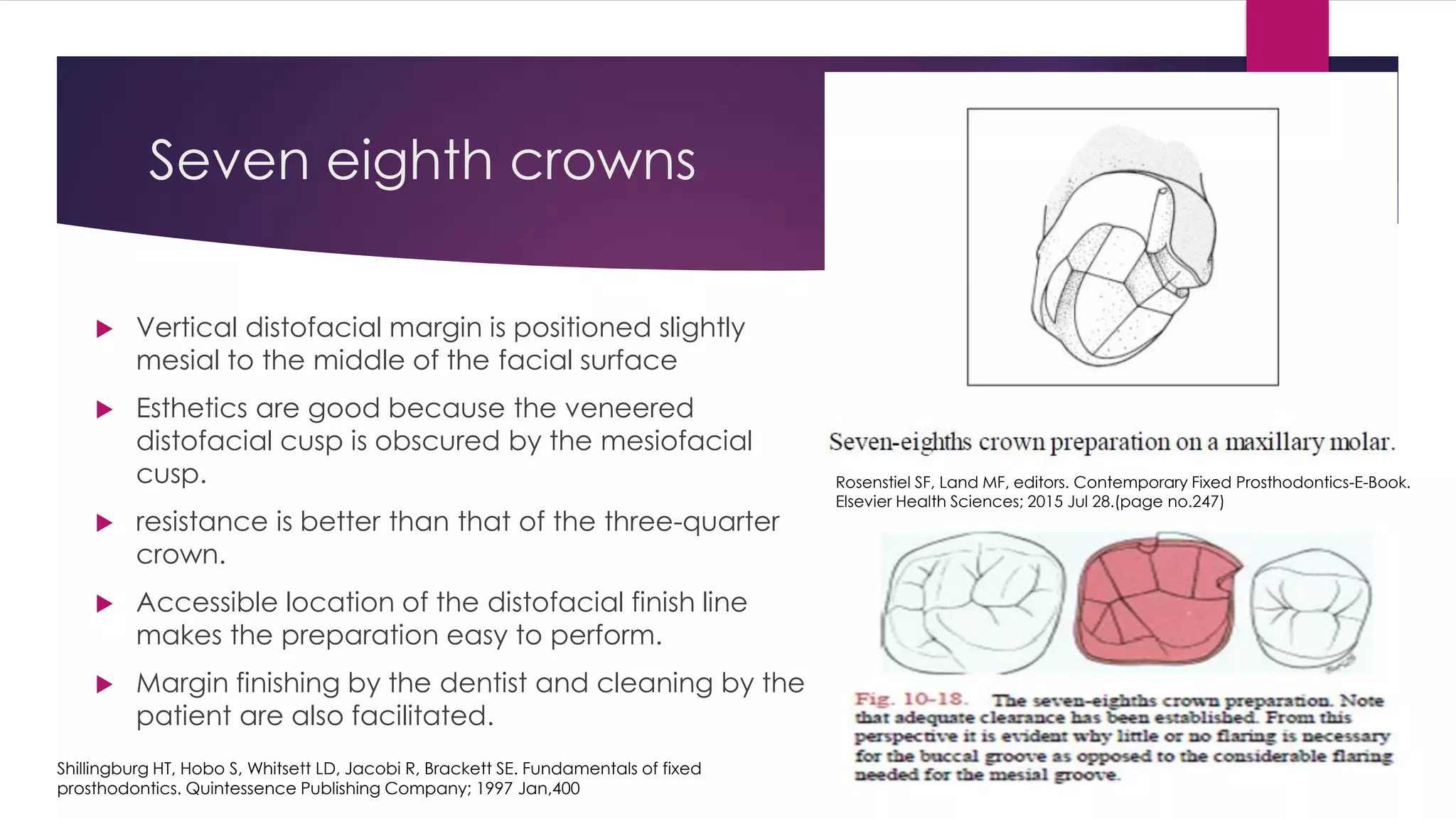 Retainers in FPD (FIXED PARTIAL DENTURES) PDF copy | PDF