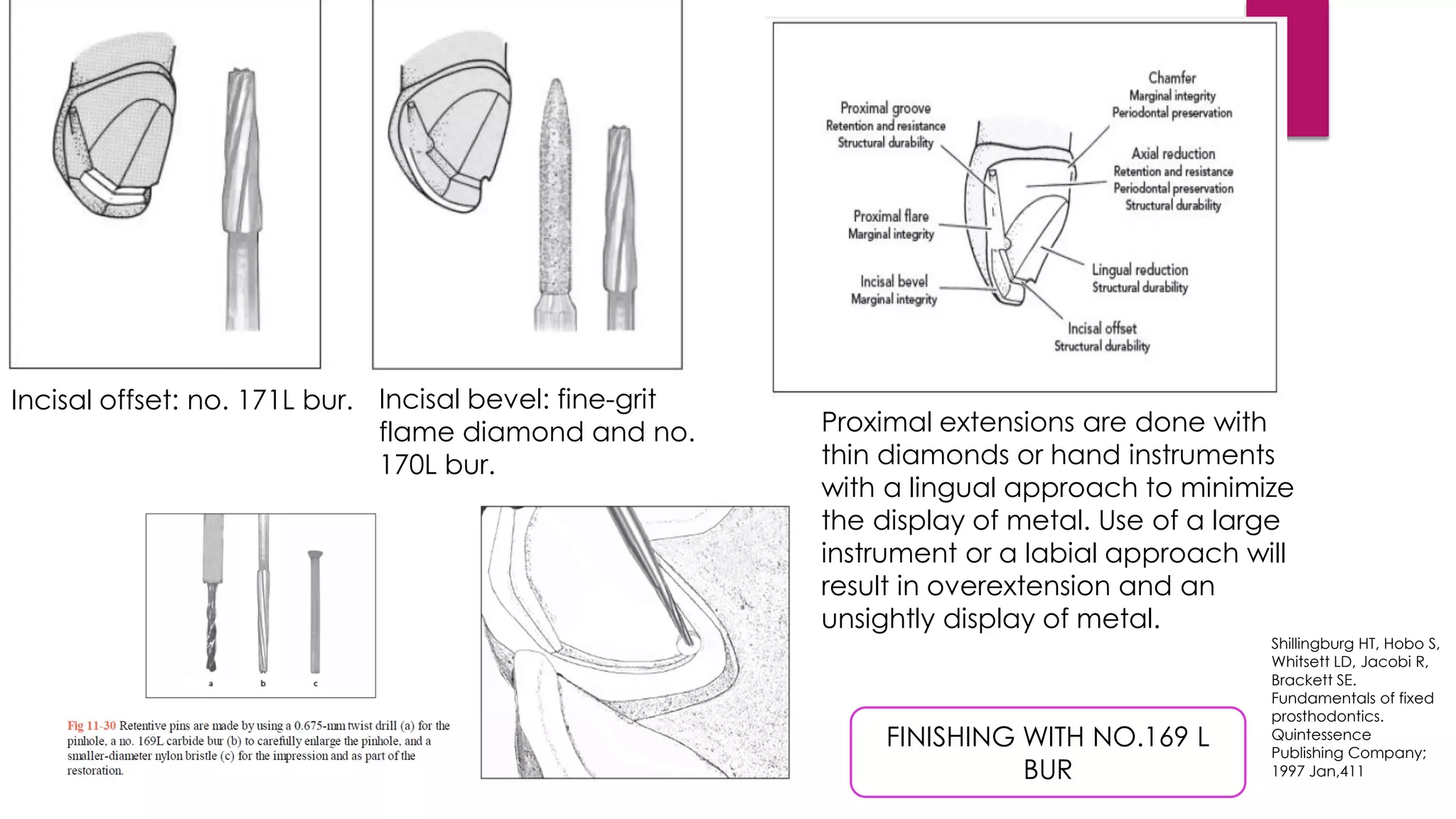 Retainers in FPD (FIXED PARTIAL DENTURES) PDF copy | PDF